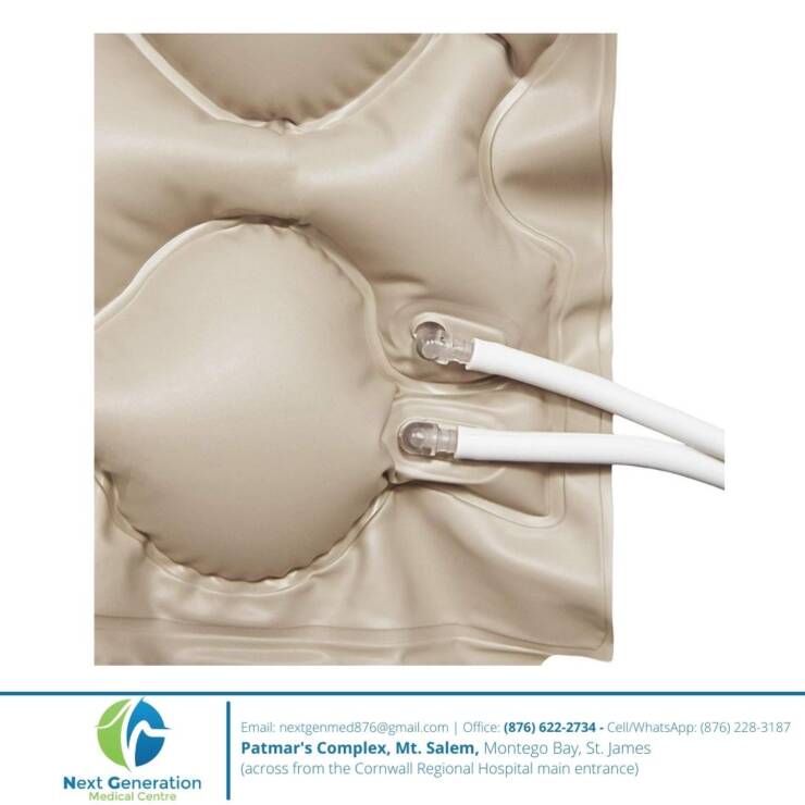 Alternating Pressure Pad - Next Generation Medical Center